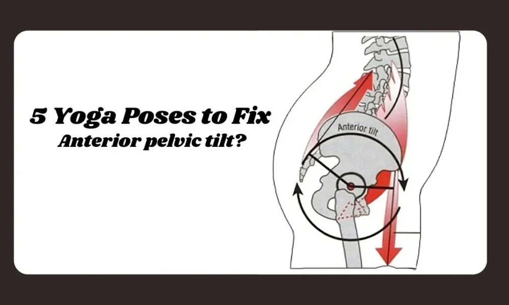 5 Yoga Poses to Fix Anterior Pelvic Tilt